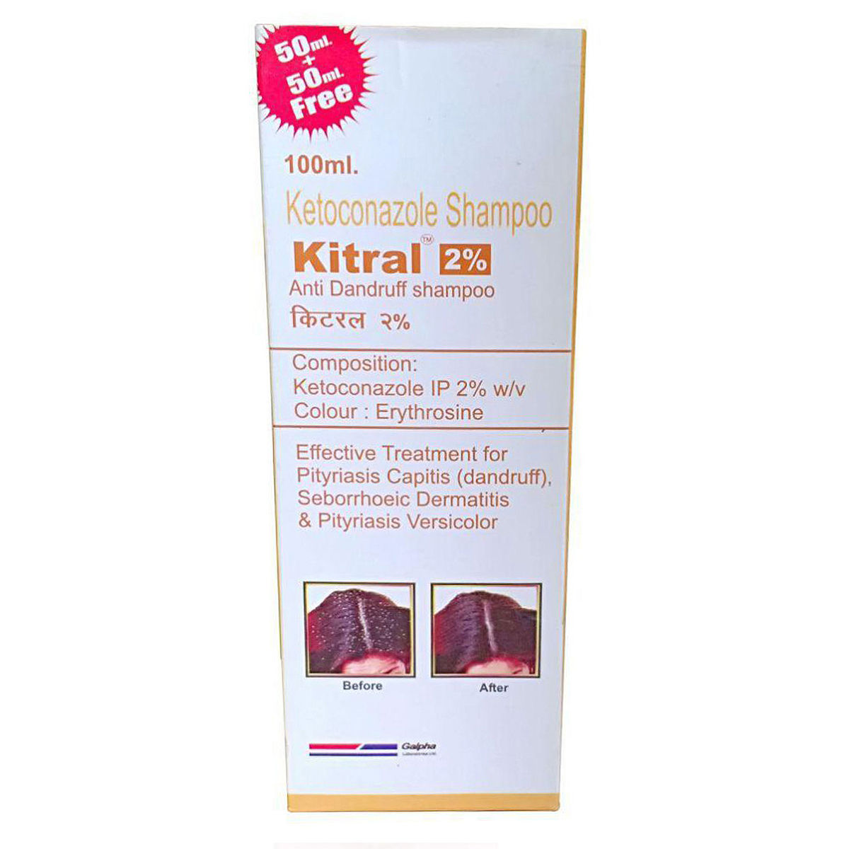 Kitral 2% Anti Dandruff Shampoo, 100 ml Price, Uses, Side Effects ...