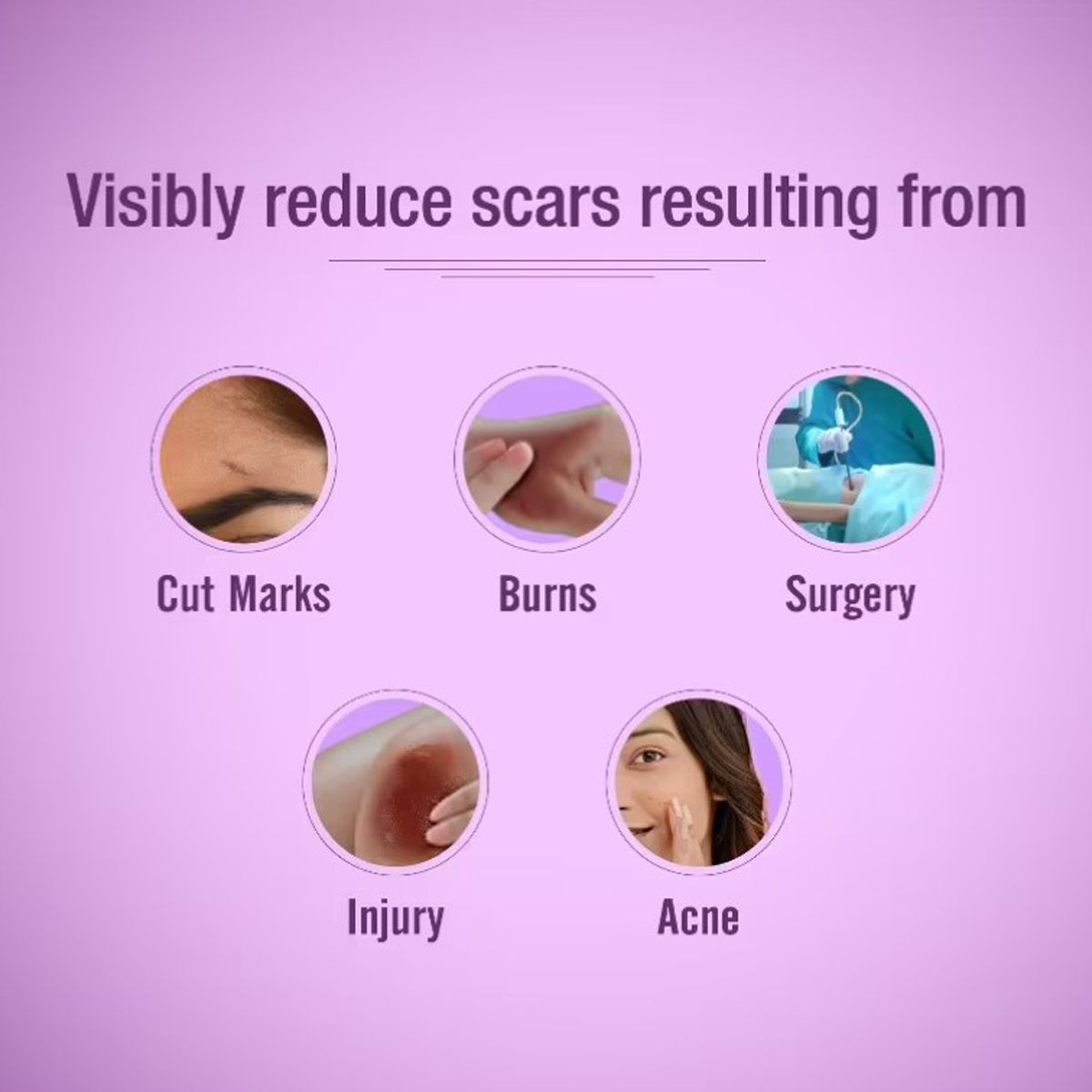 Mederma Advanced Plus Scar Gel, 10 gm Price, Uses, Side Effects ...