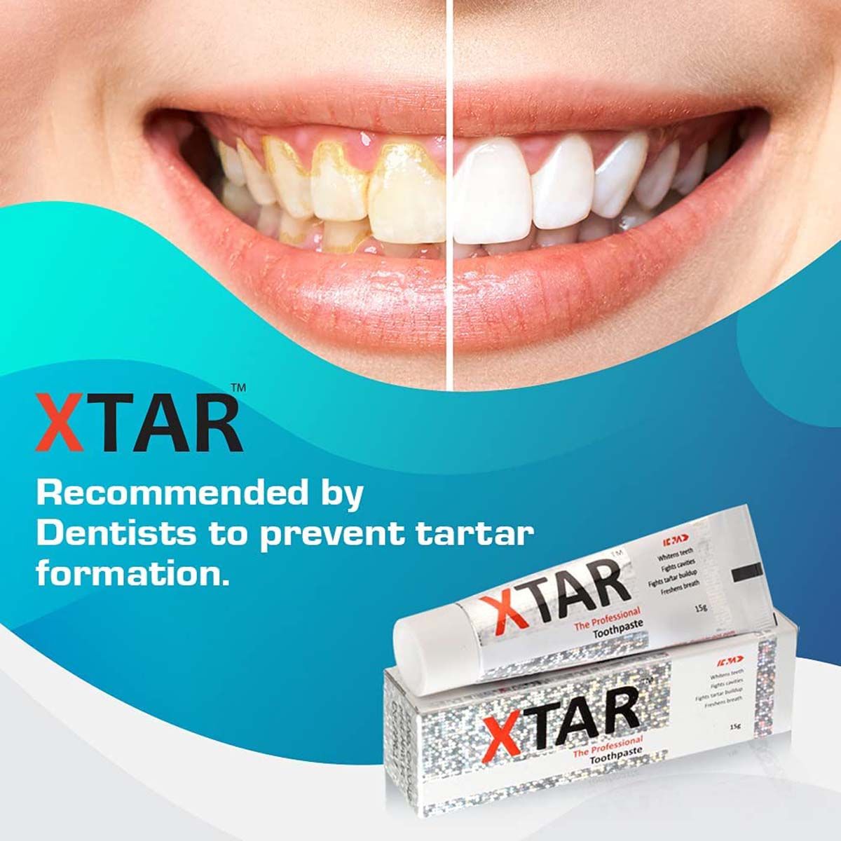 Xtar Toothpaste, 100 gm Price, Uses, Side Effects, Composition - Apollo ...