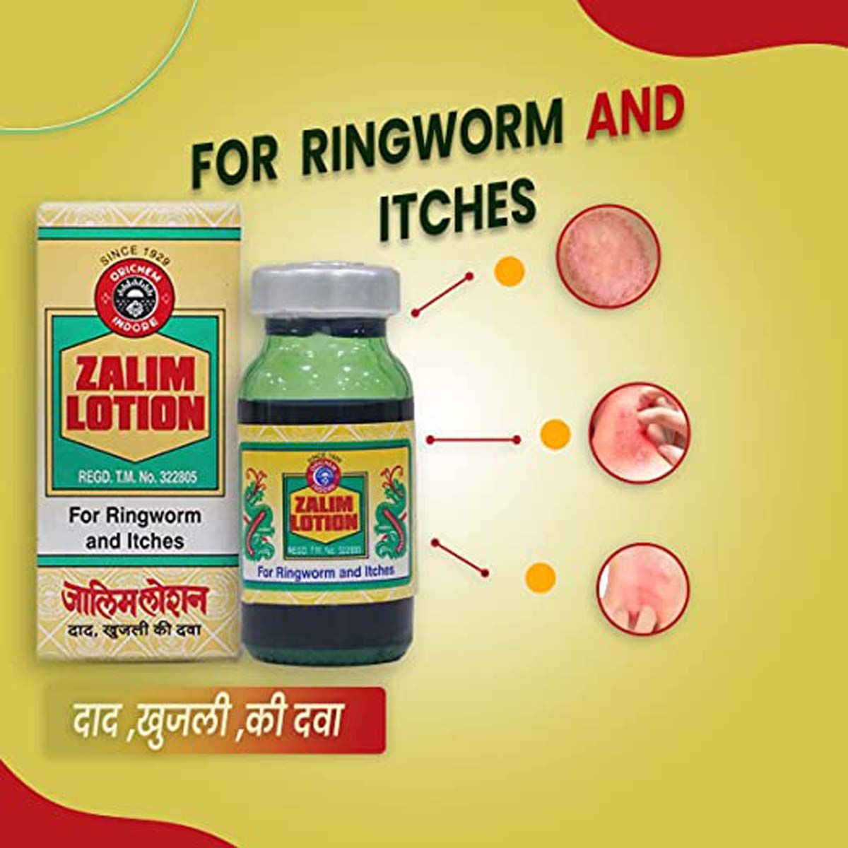 Zalim Lotion, 10 ml Price, Uses, Side Effects, Composition - Apollo ...